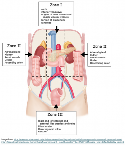 EM@3AM: Retroperitoneal Hematoma - emDocs