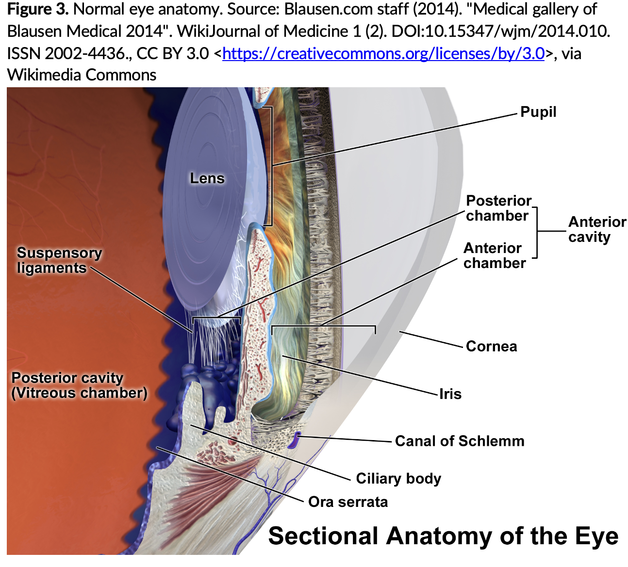 EM@3AM: Acute Angle Closure Glaucoma - emDocs