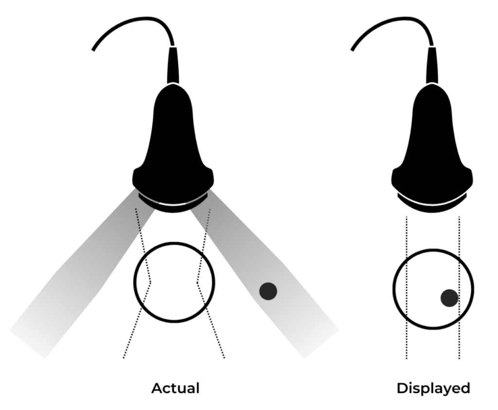US Probe: An Abundance of Artifacts - emDocs