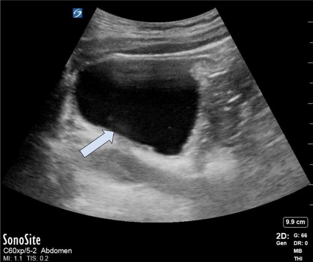 US Probe: An Abundance of Artifacts - emDocs