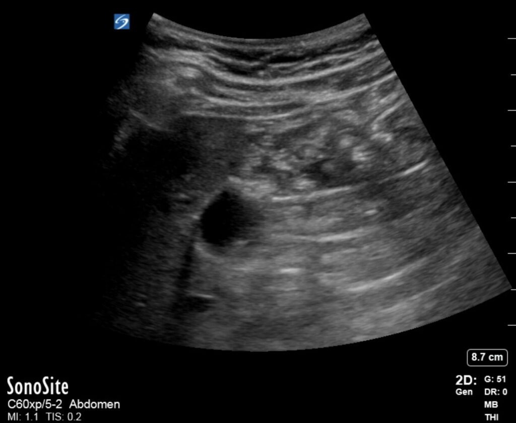 US Probe: An Abundance of Artifacts - emDocs