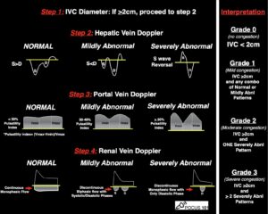 US Probe: Assessing Venous Congestion - The VExUS Approach - emDocs