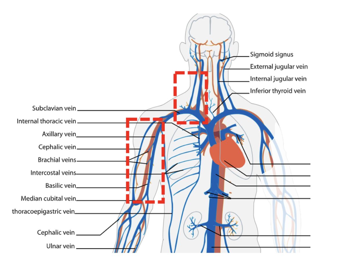 US Probe: Upper Extremity DVT - emDocs