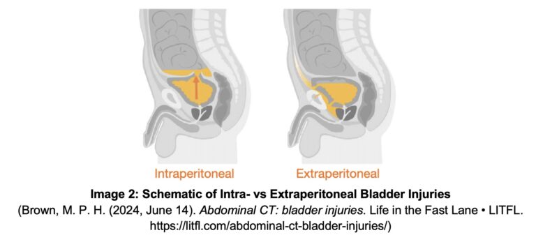 EM@3AM: Genitourinary Trauma - emDocs