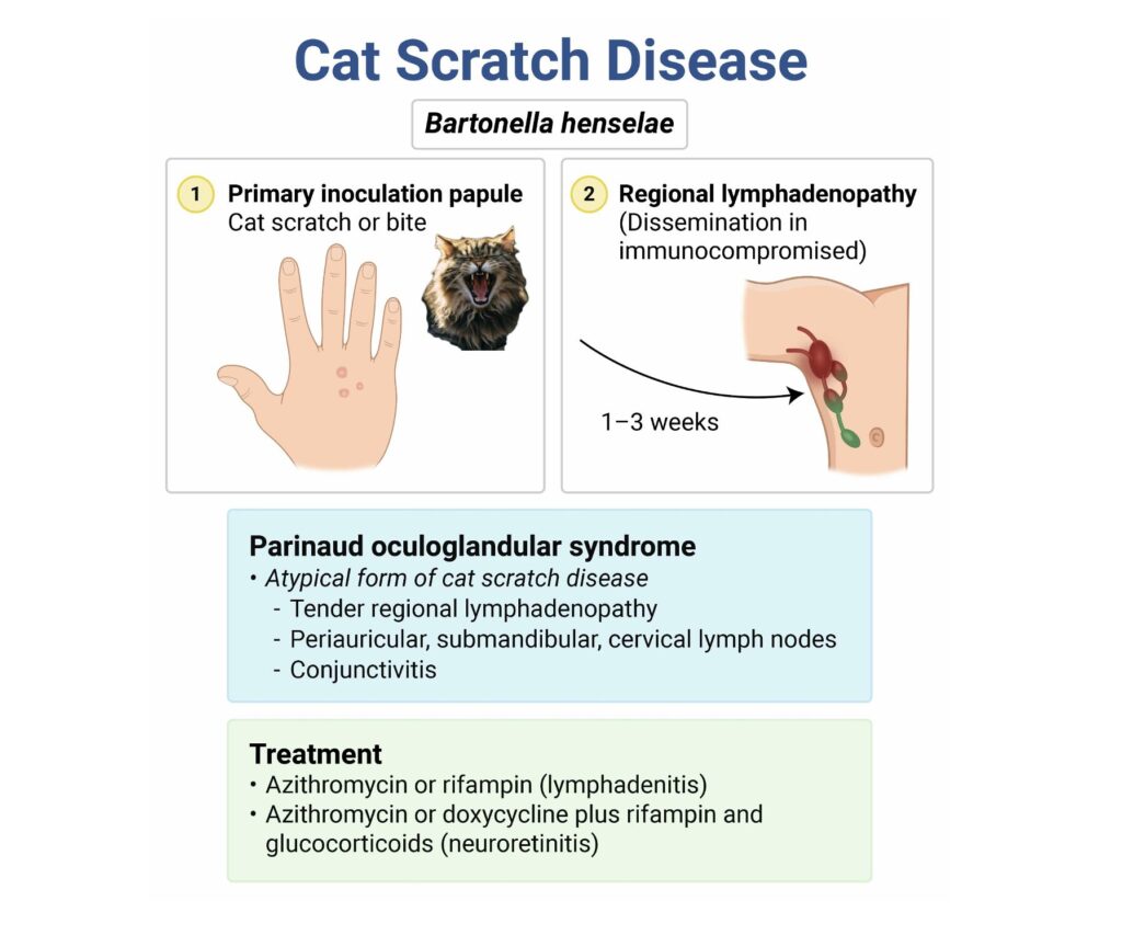 EM@3AM: Cat-Scratch Disease - emDocs