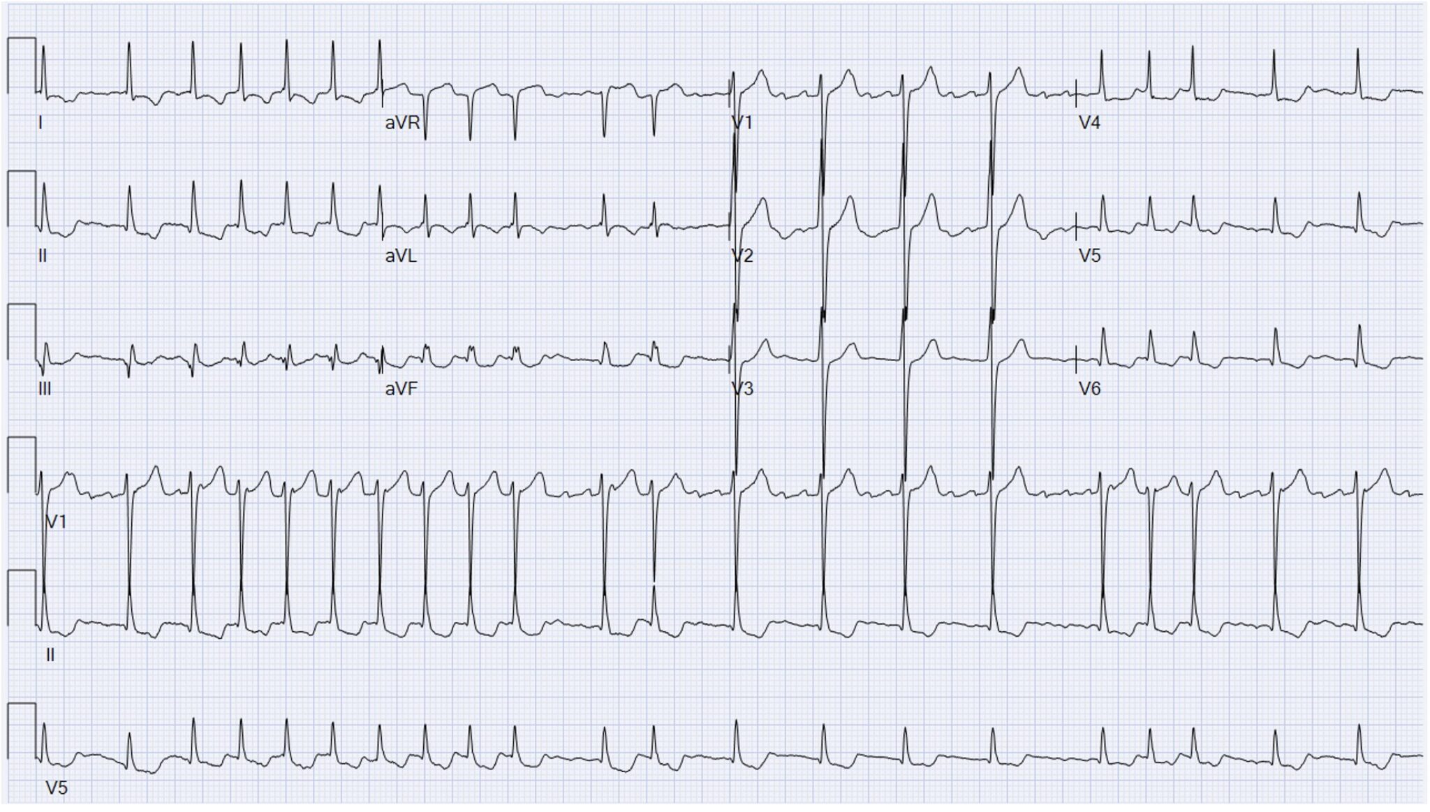 ECG Pointers: A Special Fictional Morbidity and Mortality Conference ...