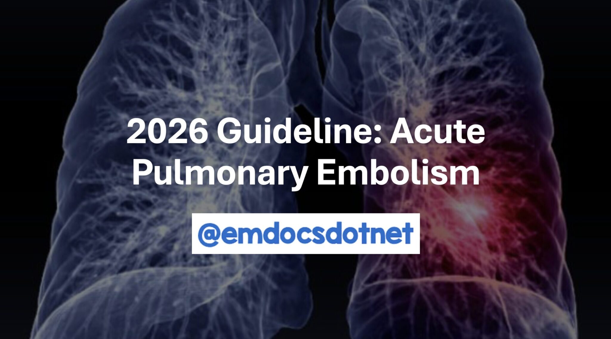 2026 Guideline: Evaluation and Management of Acute PE - emDocs